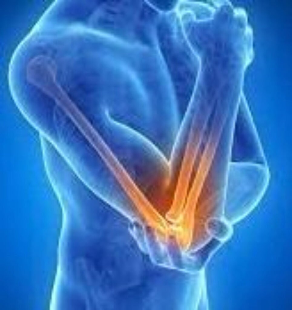 Golfers Elbow Physiotherapy & Rehab | My Pain Clinic Global