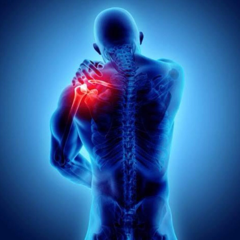 Muscle Strain & Sprain Physiotherapy Recovery | My Pain Clinic Global